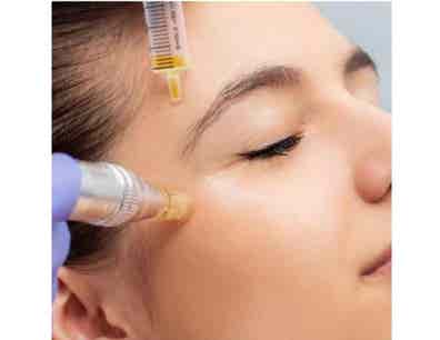 Milanuncios - Hidratación de labios con dermapen 20€