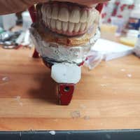 Milanuncios - Protésico Dental